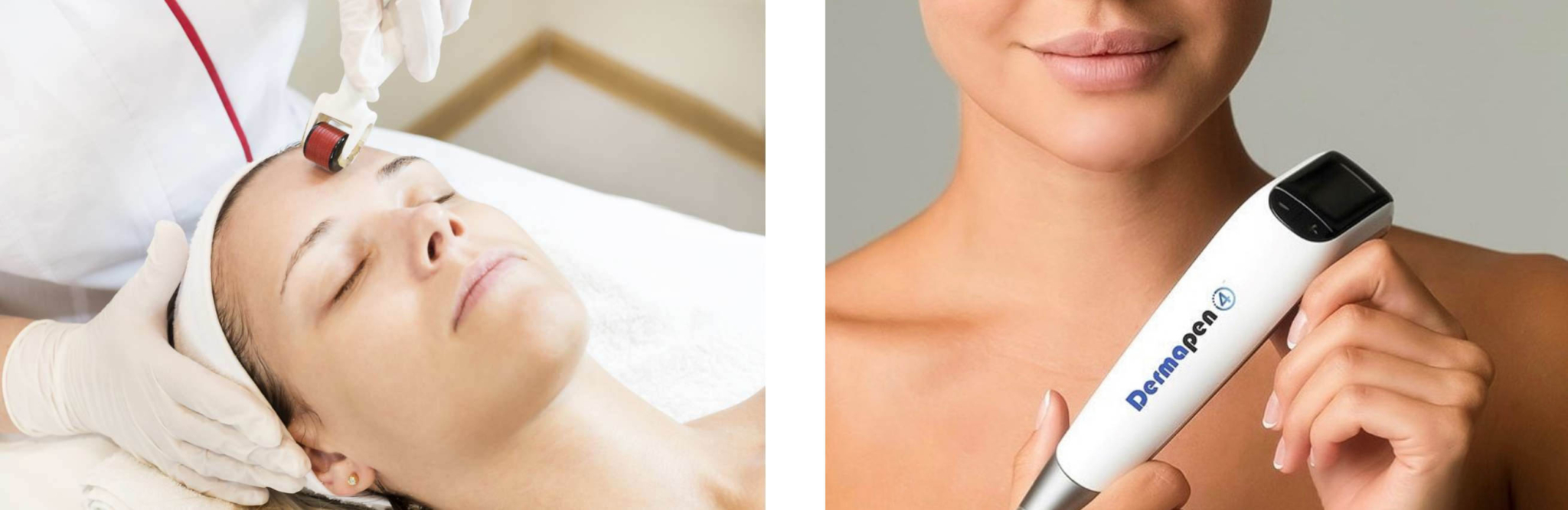 Dermaroller - Dermapen Needling - DermaLab